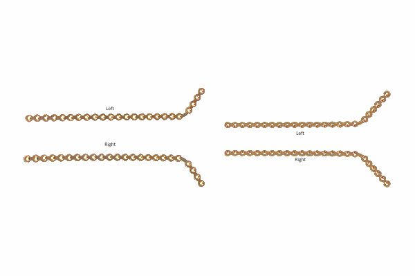 Titanium UltraLock® Mandibular Reconstruction Plates Single Angle ...